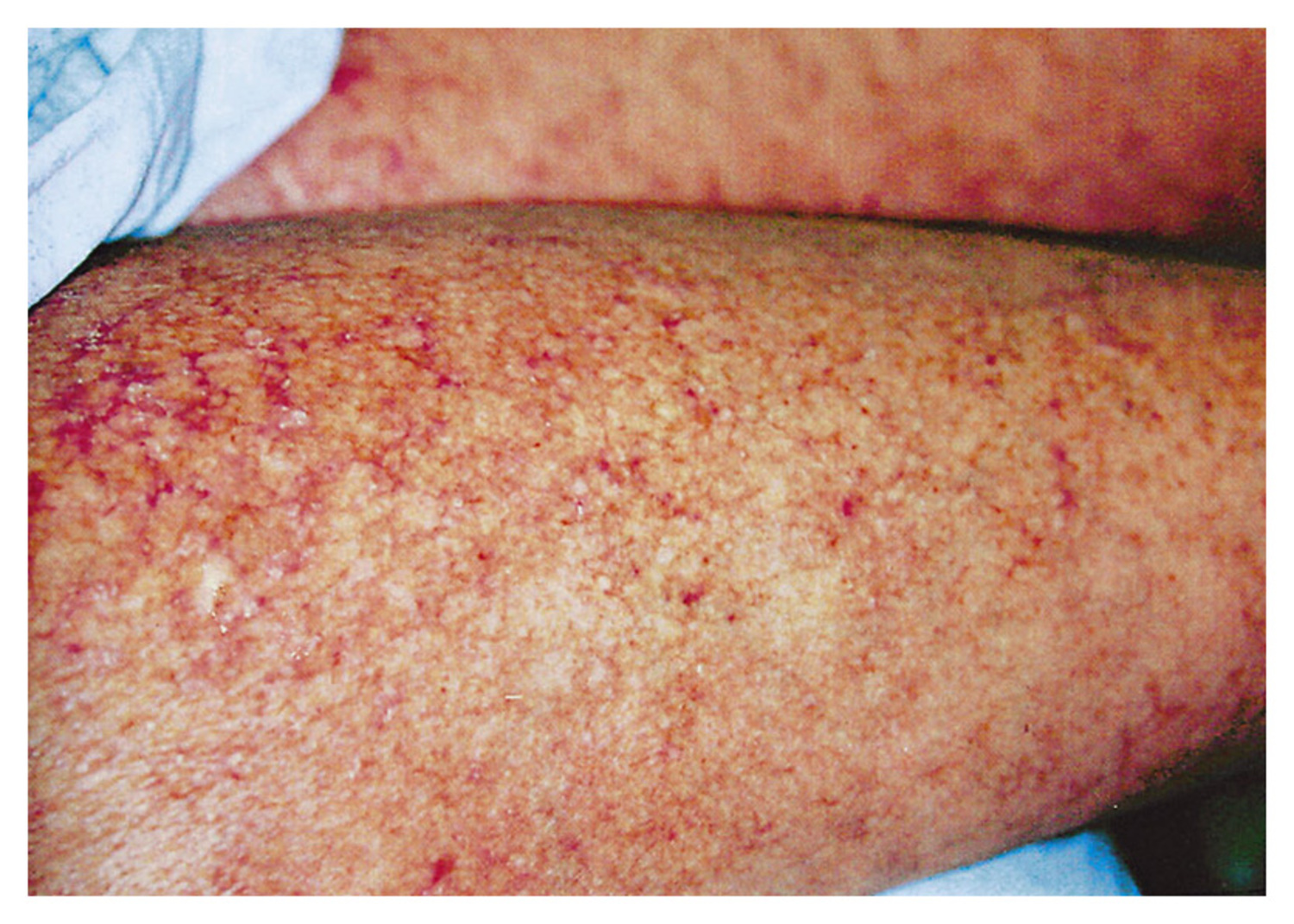 Image Challenge | The New England Journal of Medicine