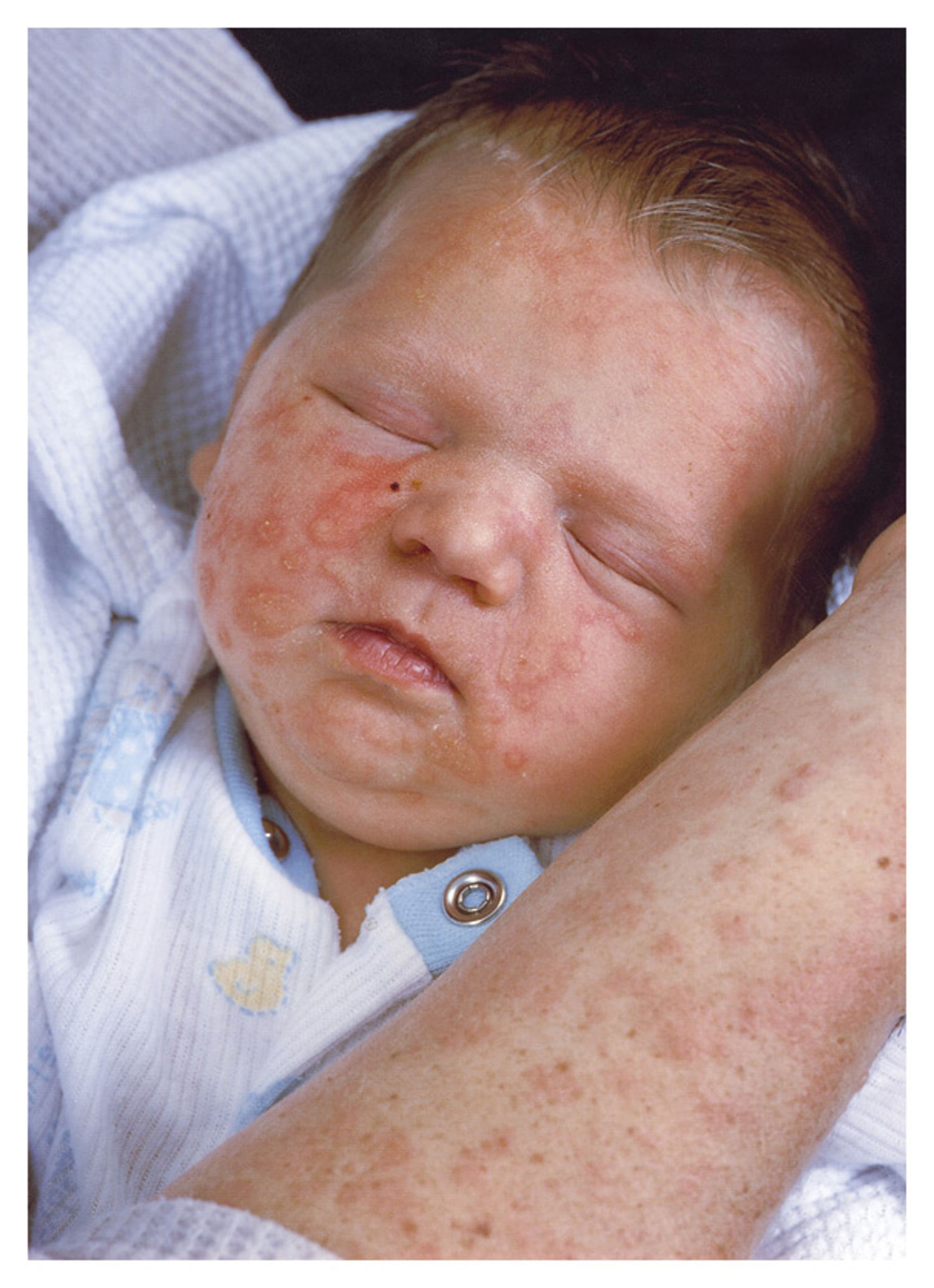 Image Challenge | The New England Journal of Medicine