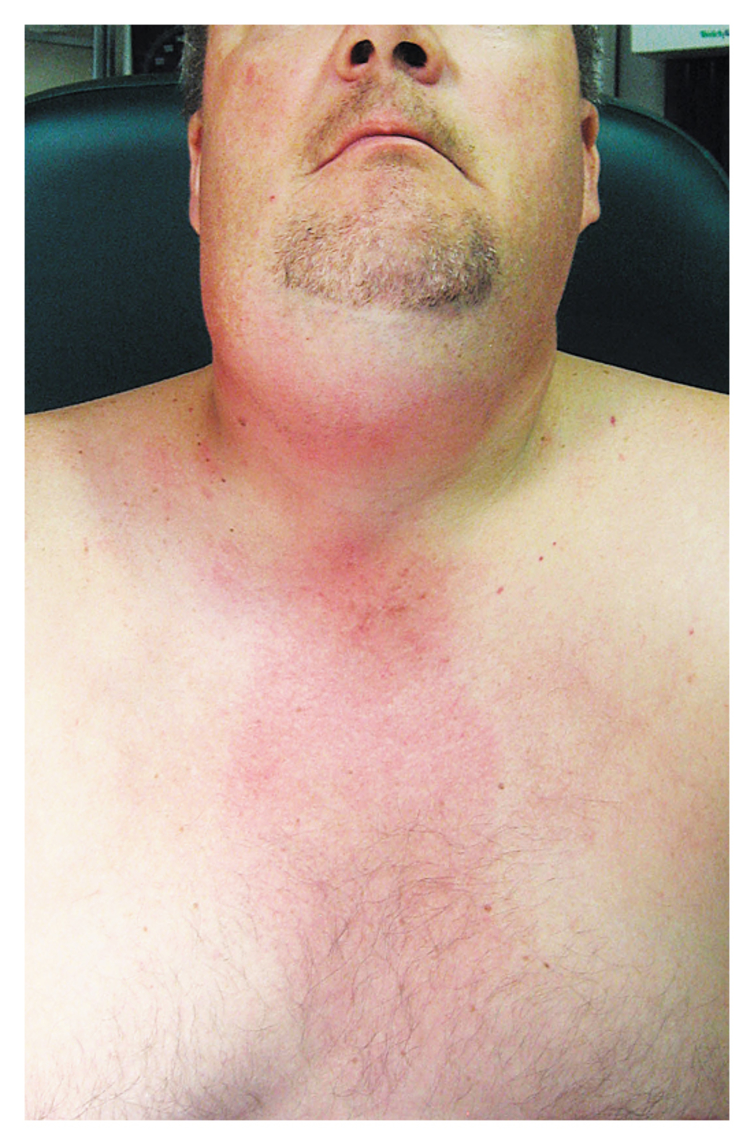 Image Challenge | The New England Journal of Medicine