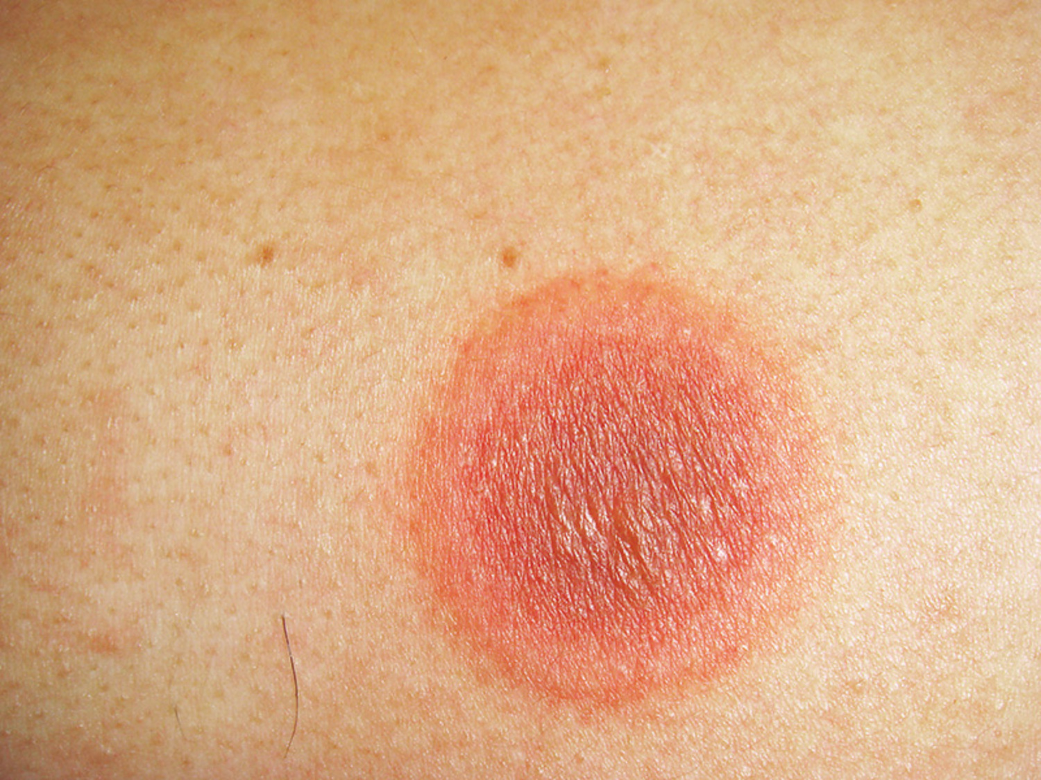 Image Challenge | The New England Journal of Medicine