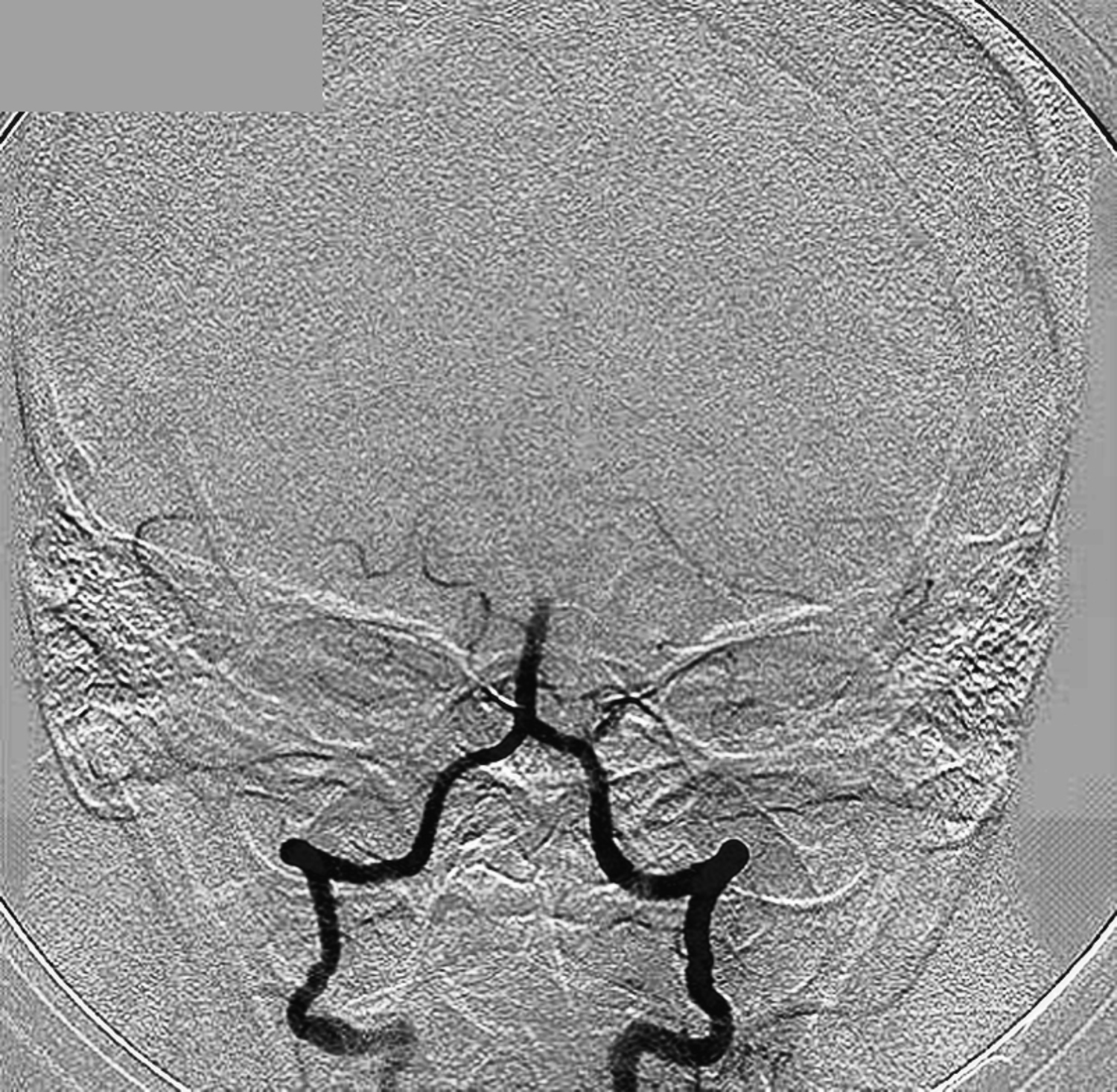 Image Challenge | The New England Journal of Medicine