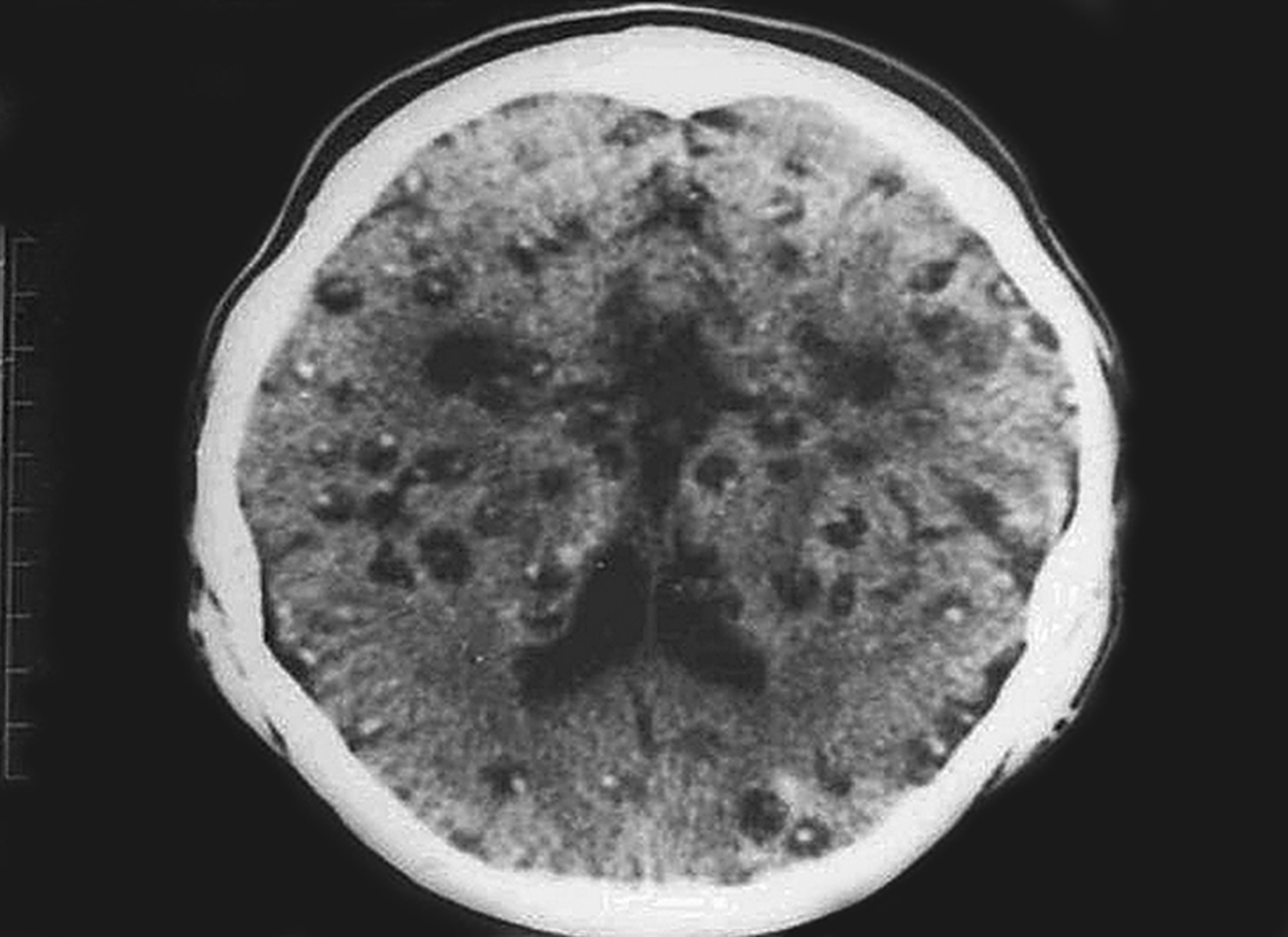 Image Challenge | The New England Journal of Medicine