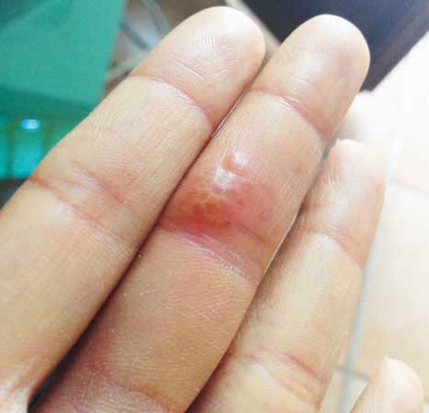 Image Challenge | The New England Journal of Medicine