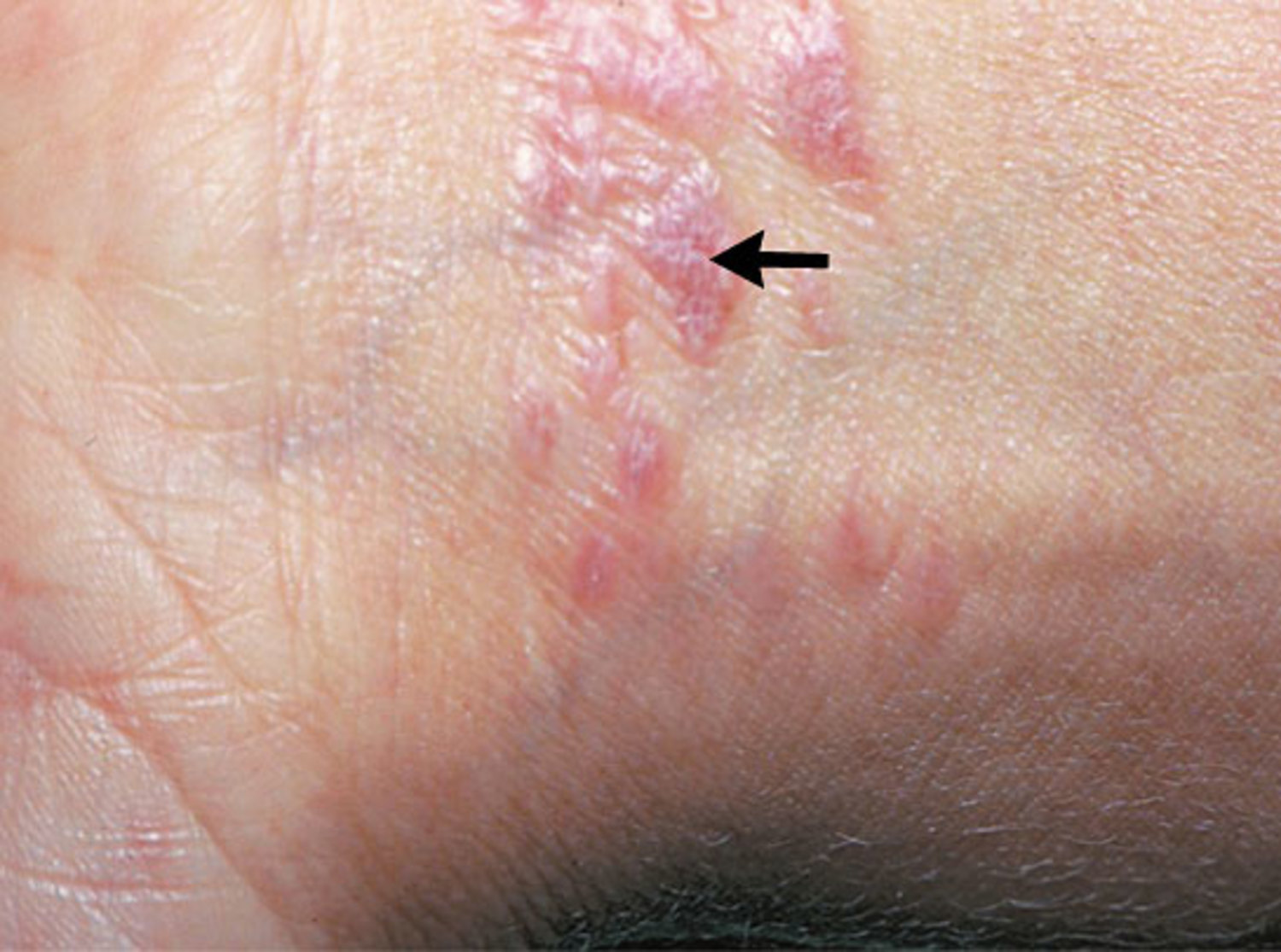 Image Challenge | The New England Journal of Medicine