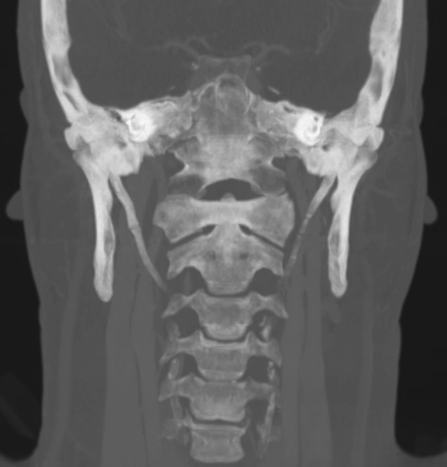 Image Challenge | The New England Journal of Medicine