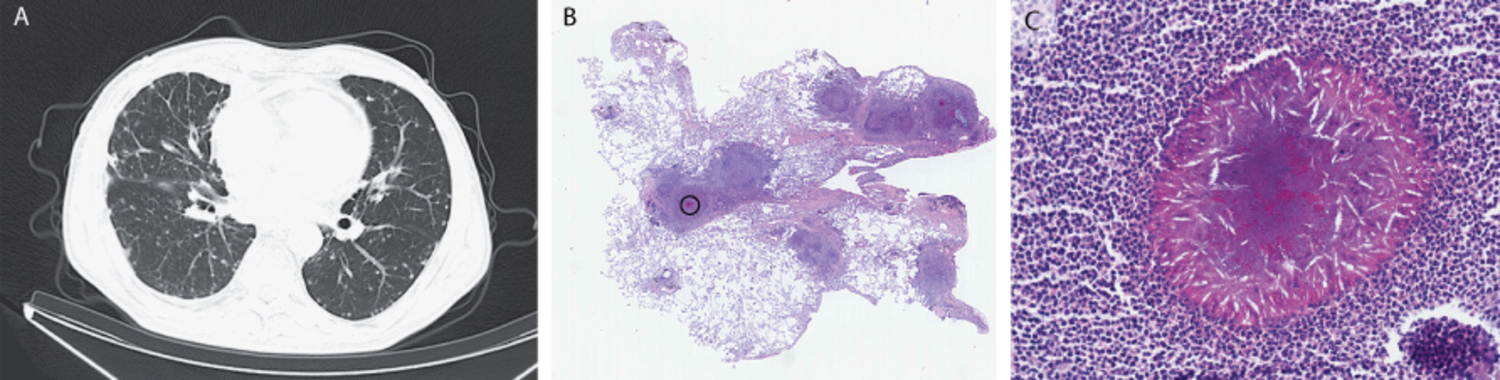 Image Challenge | The New England Journal of Medicine