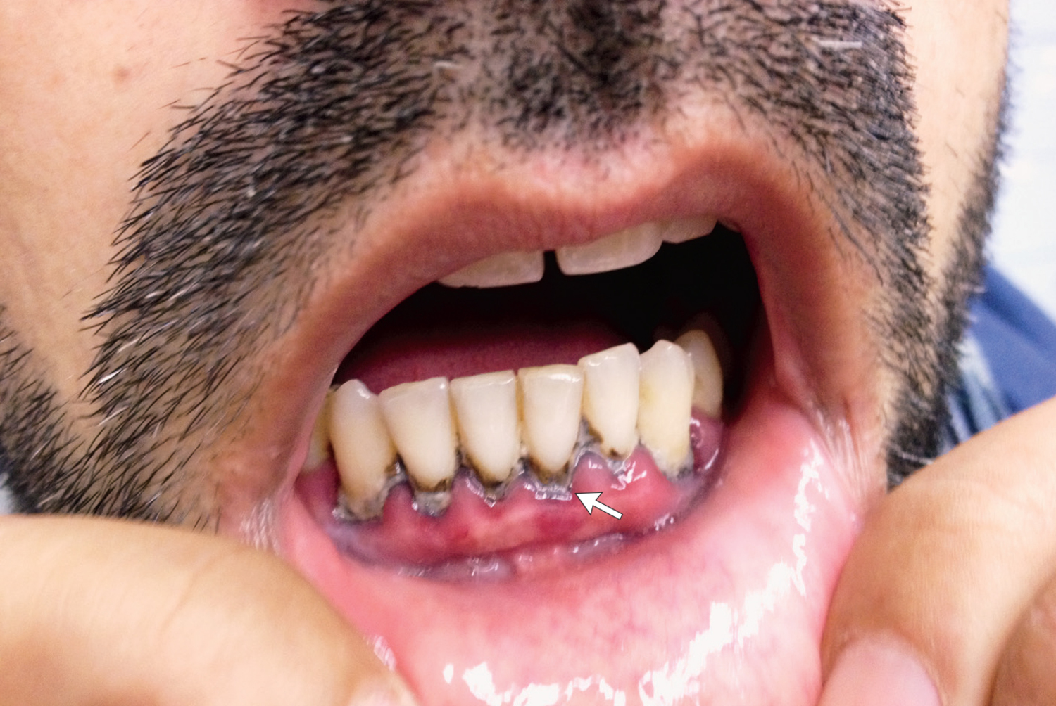 Image Challenge | The New England Journal of Medicine