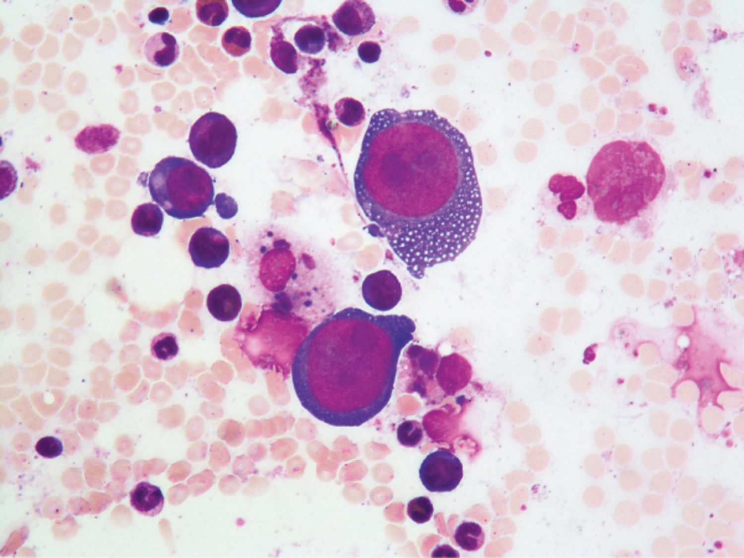 Image Challenge | The New England Journal of Medicine