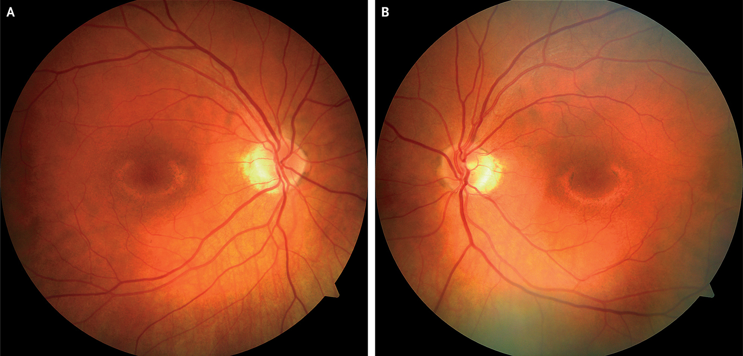 Image Challenge | The New England Journal of Medicine