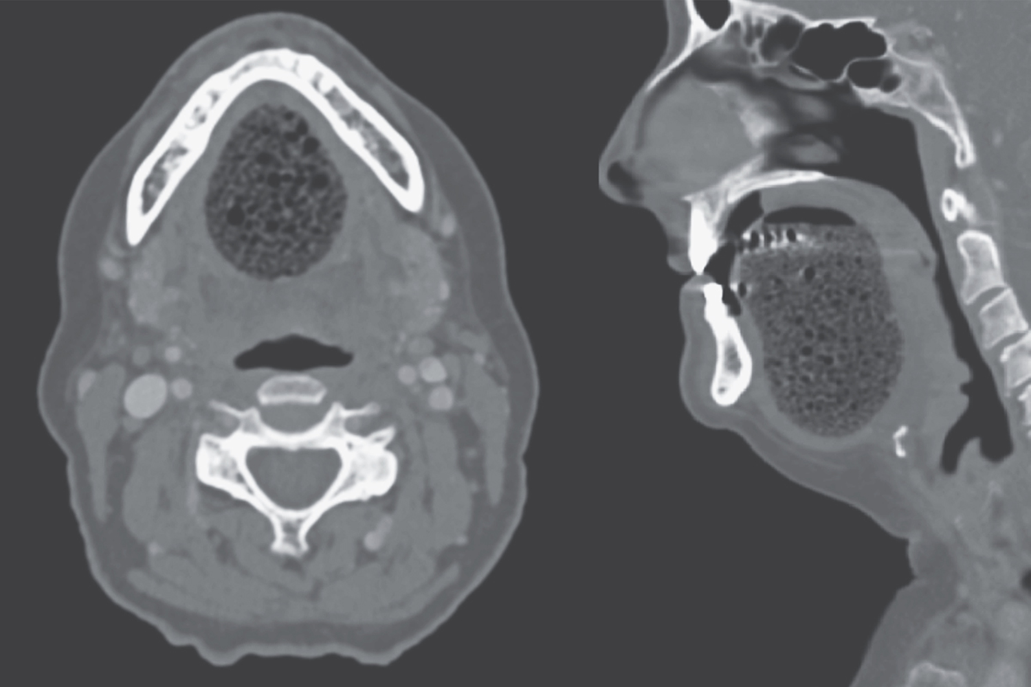 Image Challenge | The New England Journal of Medicine