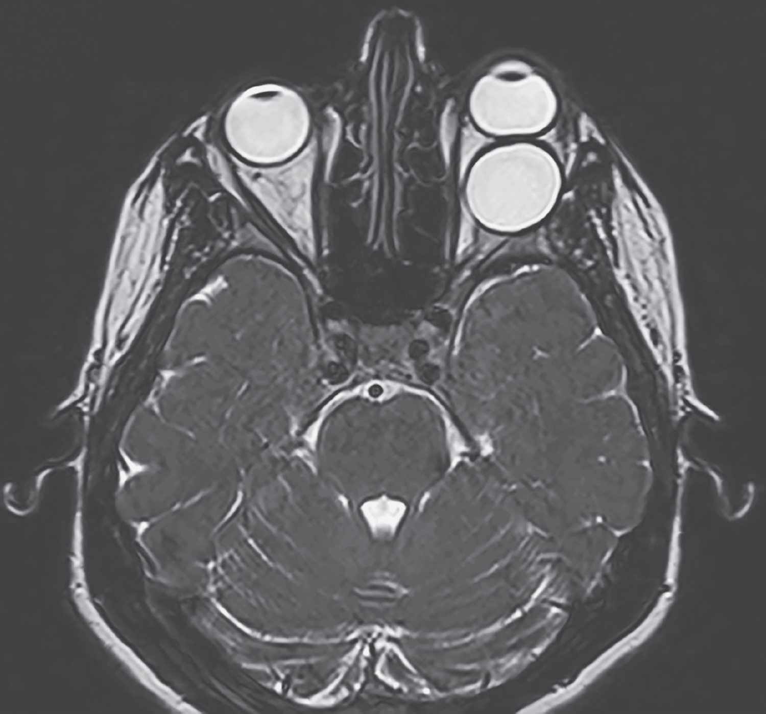 Image Challenge | The New England Journal of Medicine