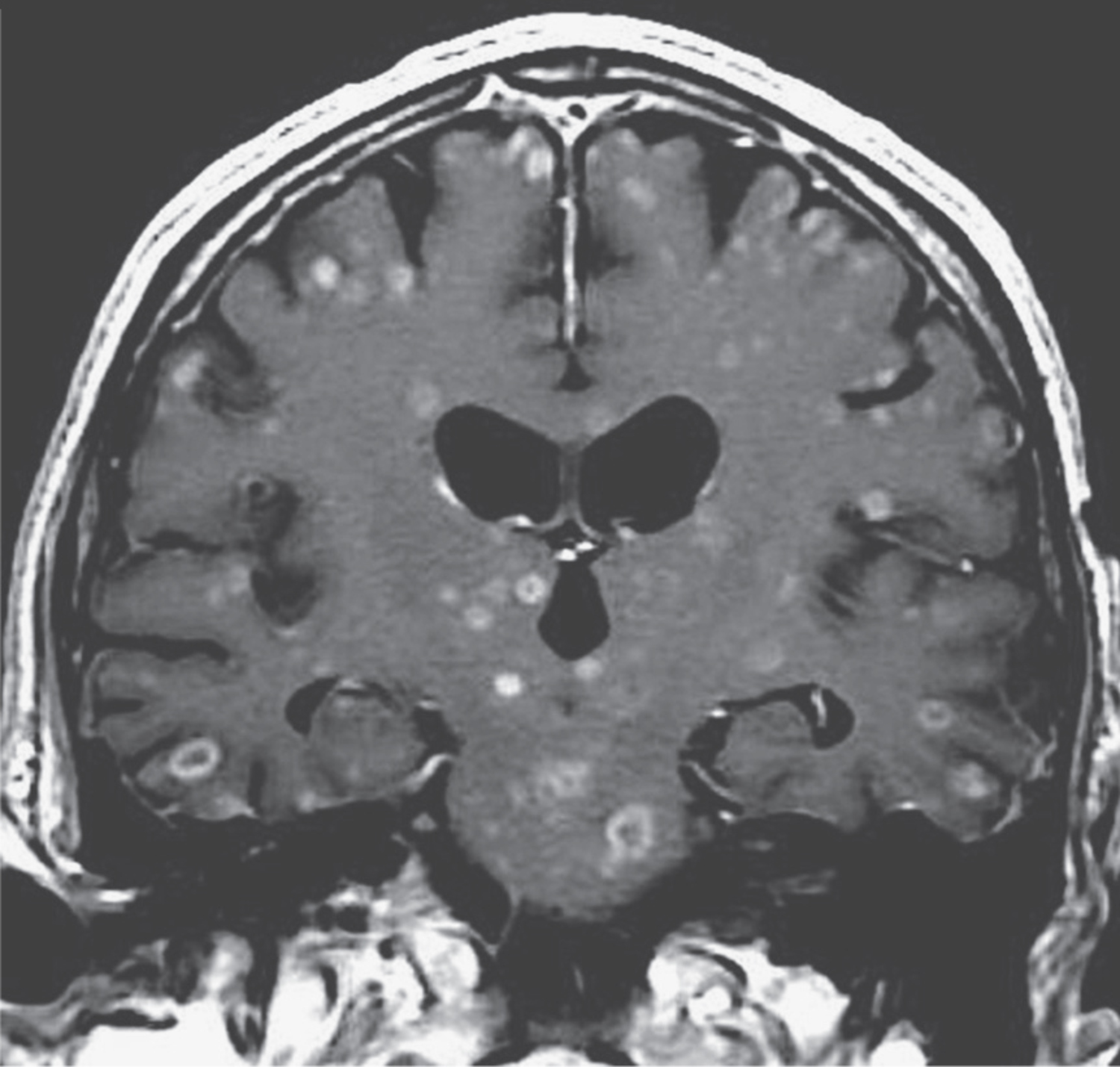 Image Challenge | The New England Journal of Medicine