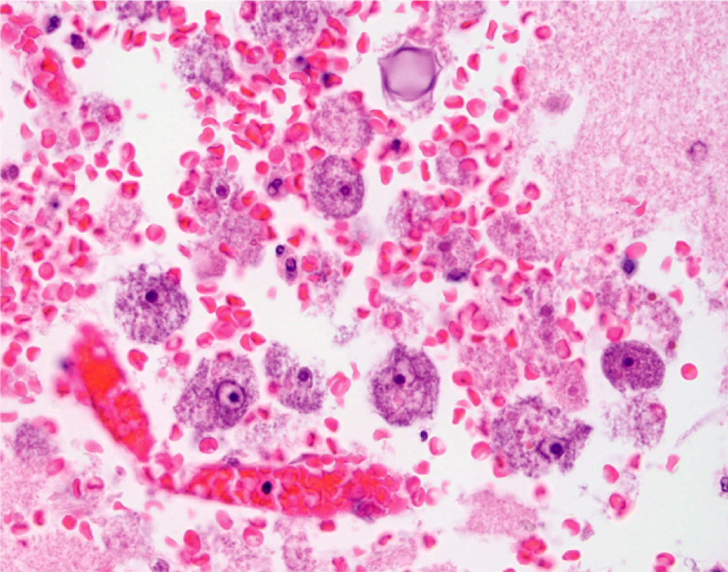 Image Challenge | The New England Journal of Medicine