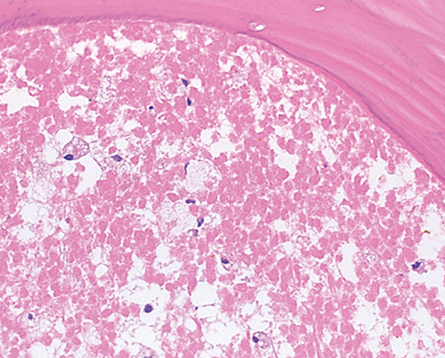 Image Challenge | The New England Journal of Medicine