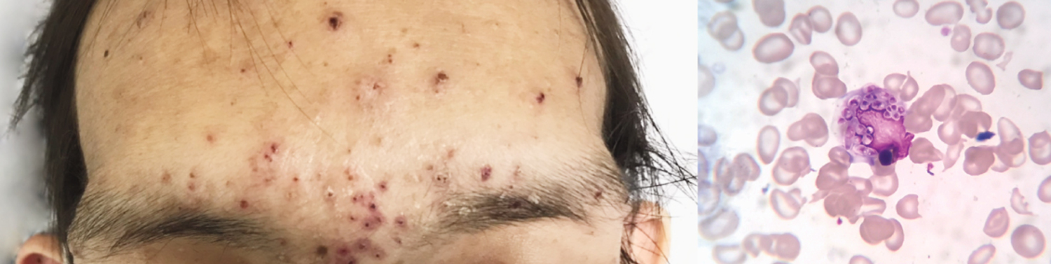 Image Challenge | The New England Journal of Medicine