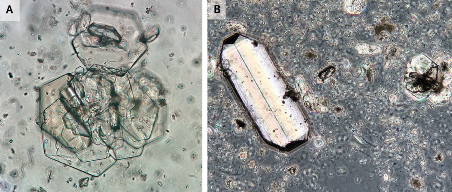 Image Challenge | The New England Journal of Medicine