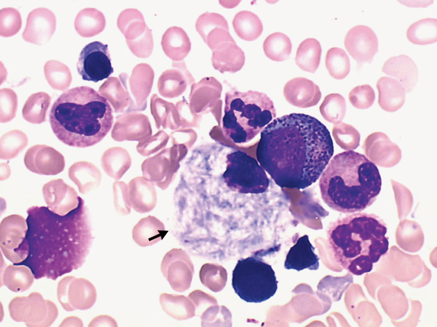 Image Challenge | The New England Journal of Medicine