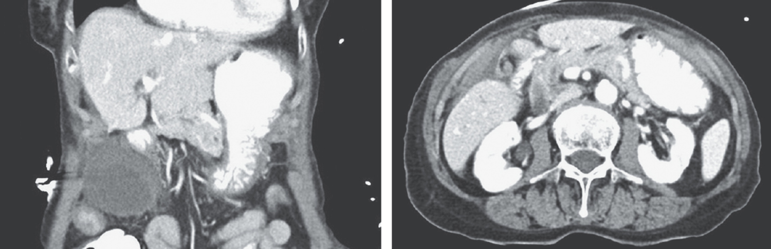Image Challenge | The New England Journal of Medicine
