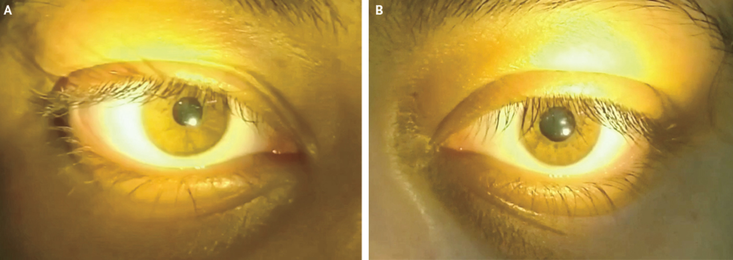 Image Challenge | The New England Journal of Medicine