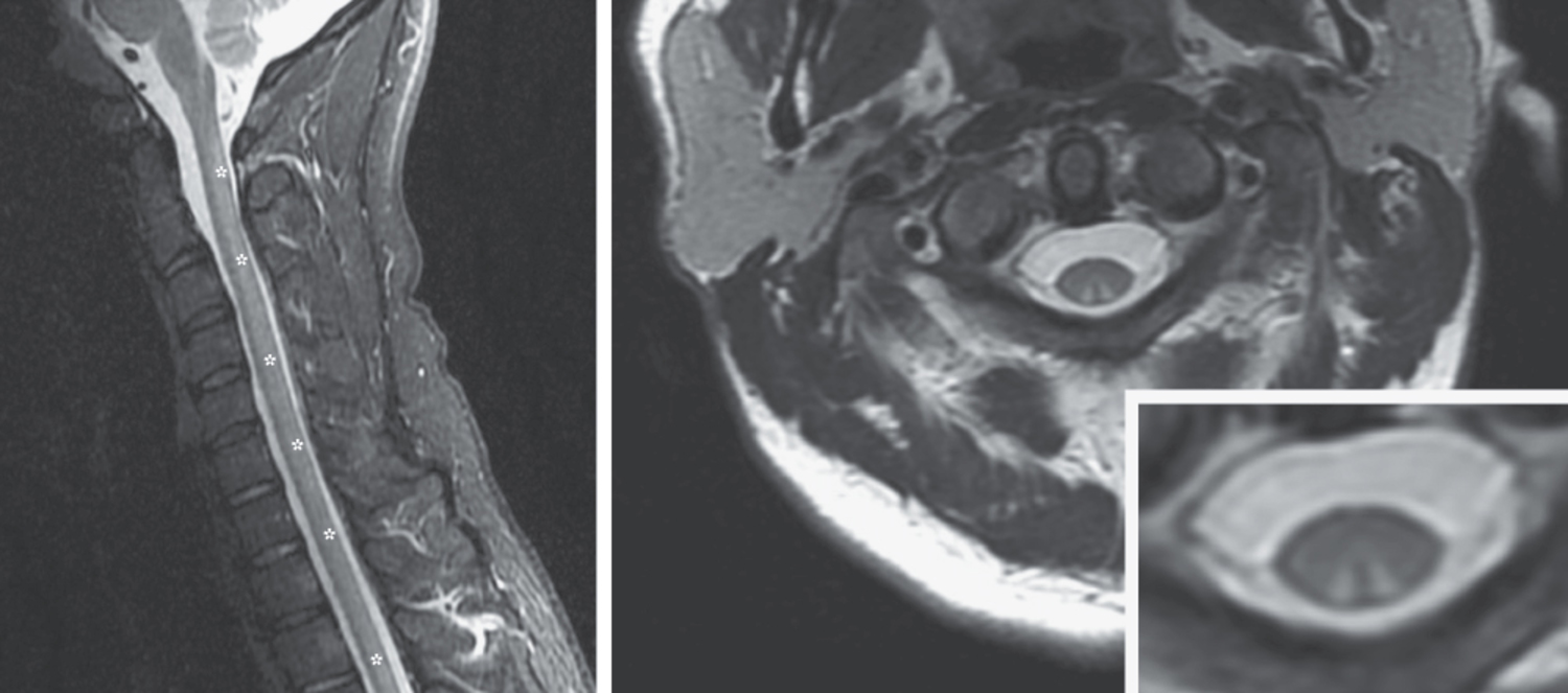 Image Challenge | The New England Journal of Medicine