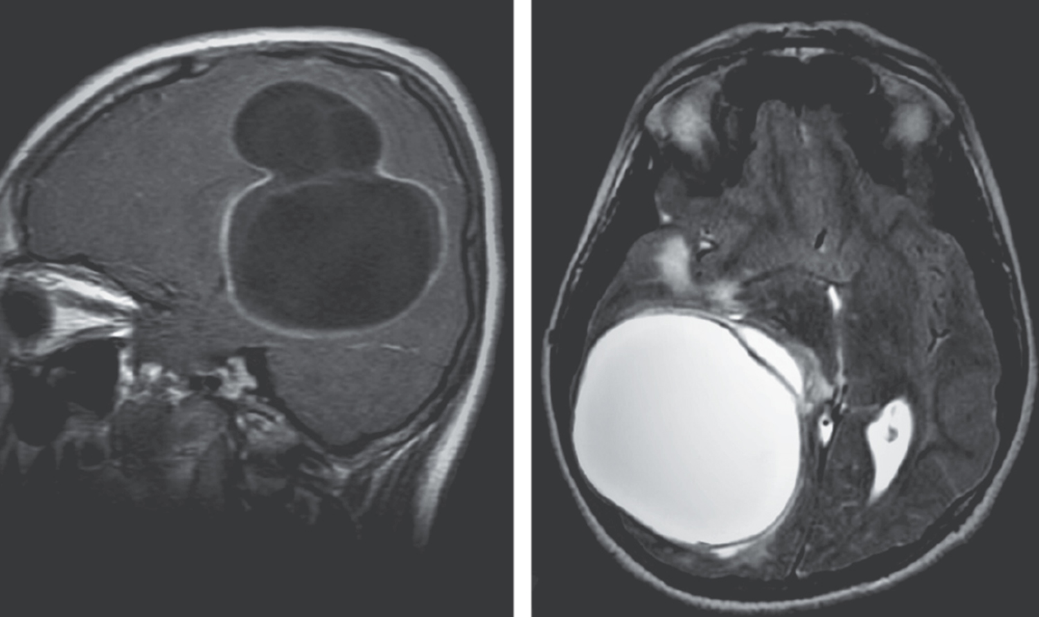 Image Challenge | NEJM