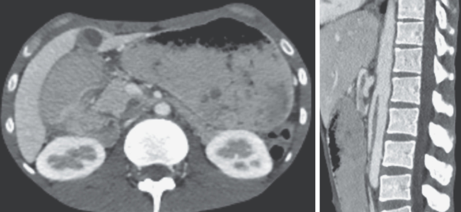 Image Challenge | The New England Journal of Medicine