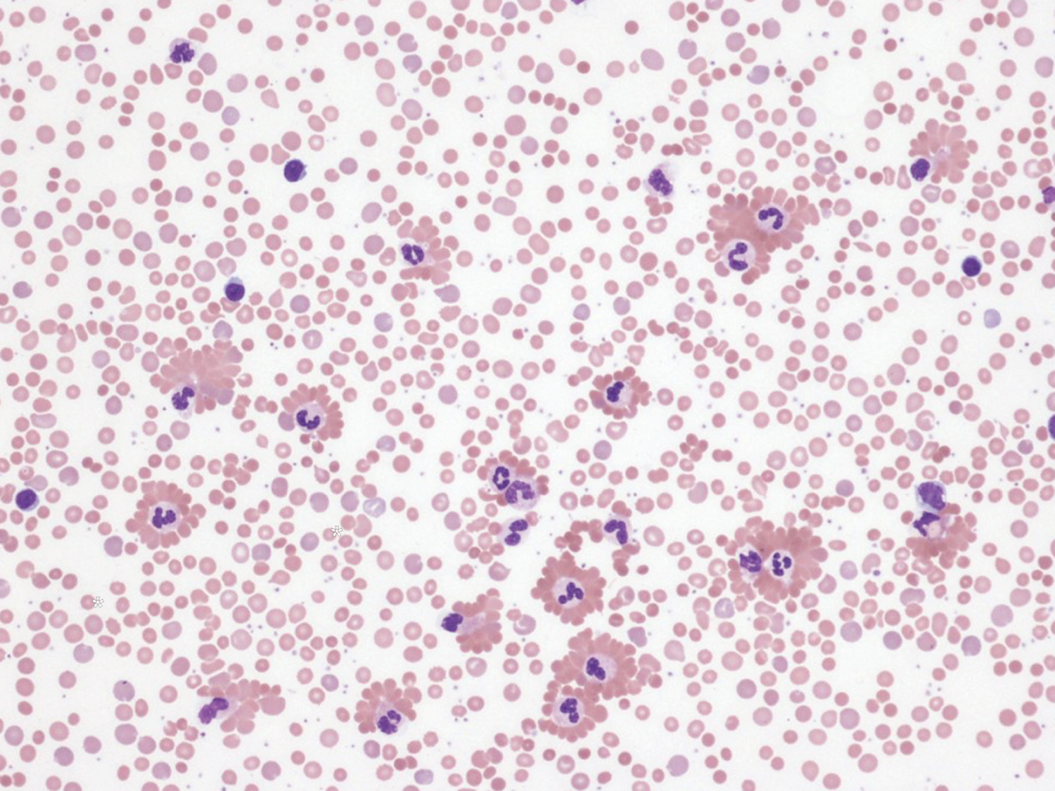 Image Challenge | The New England Journal of Medicine