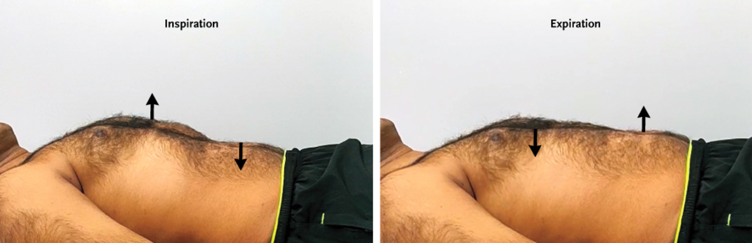 Image Challenge | The New England Journal of Medicine