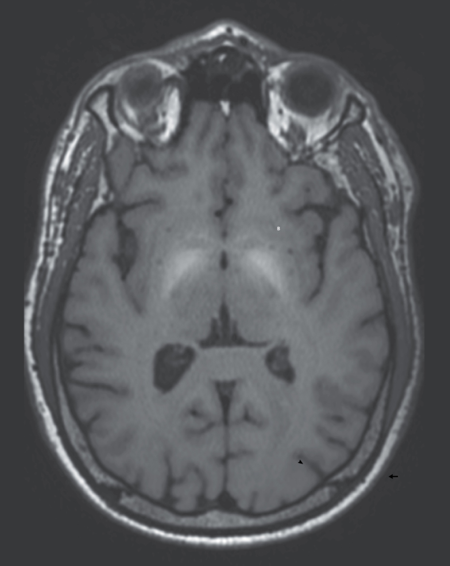 Image Challenge | The New England Journal of Medicine