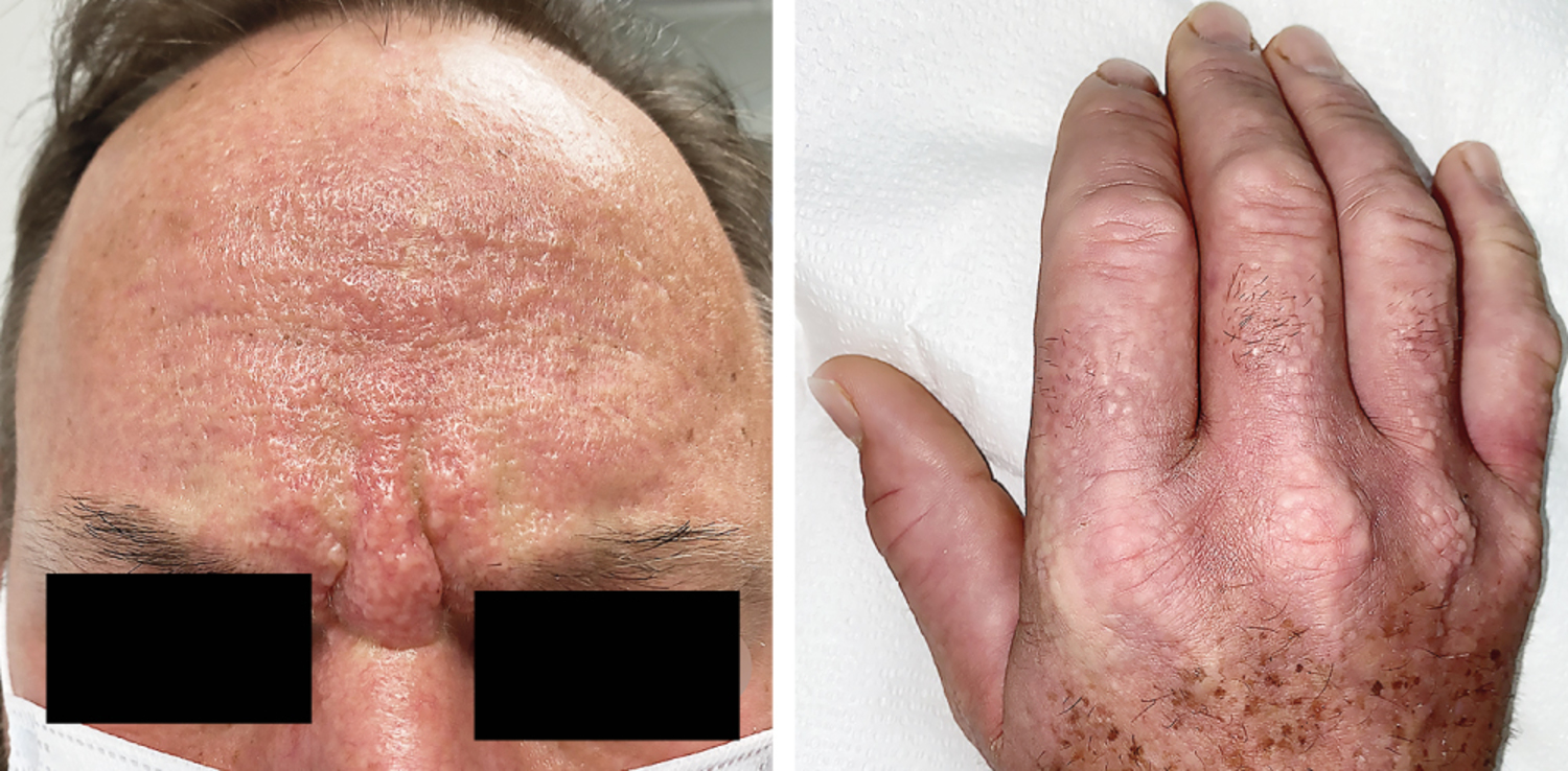 Image Challenge | The New England Journal of Medicine