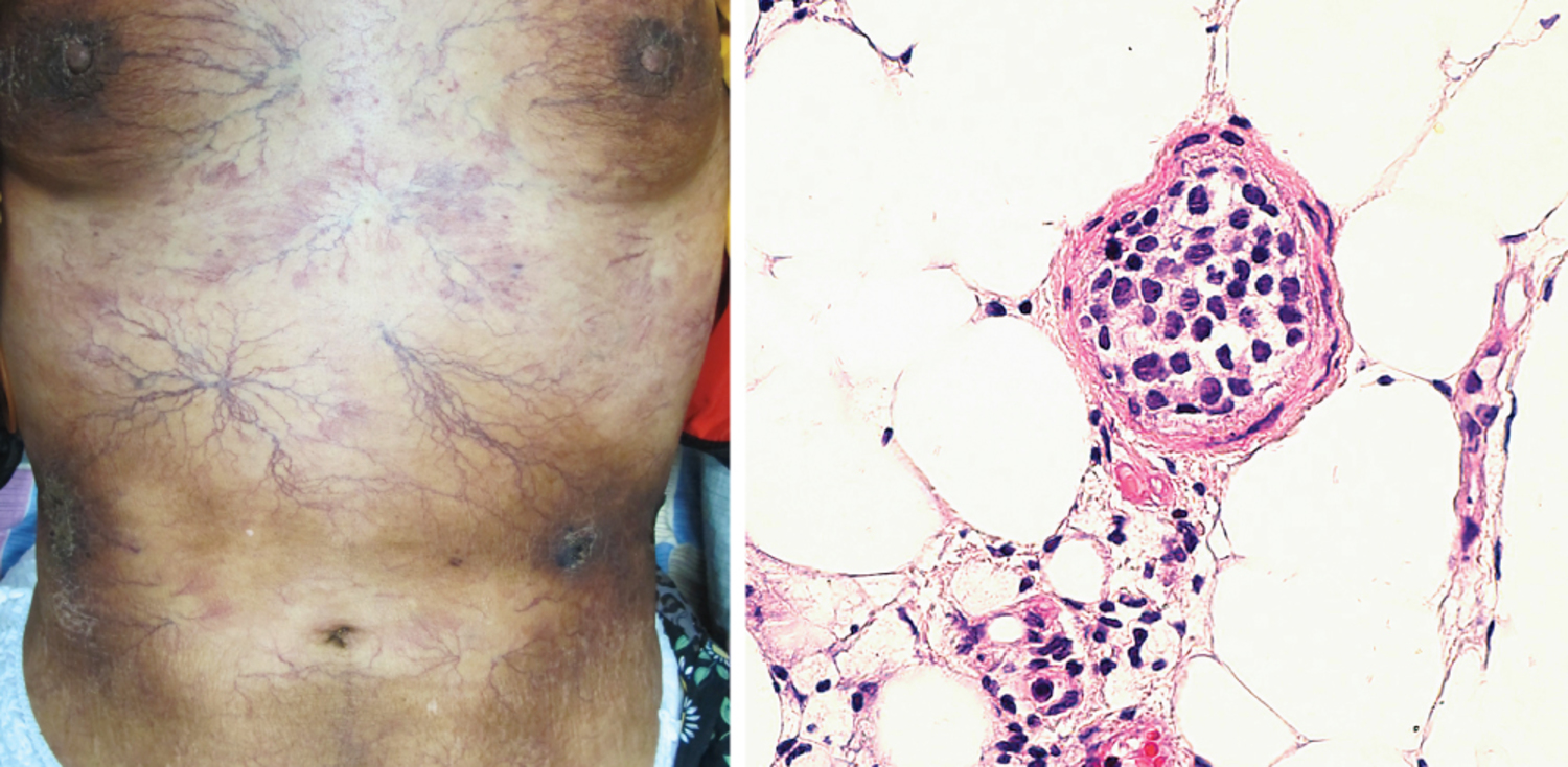 Image Challenge | The New England Journal of Medicine