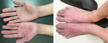 Image Challenge | The New England Journal of Medicine