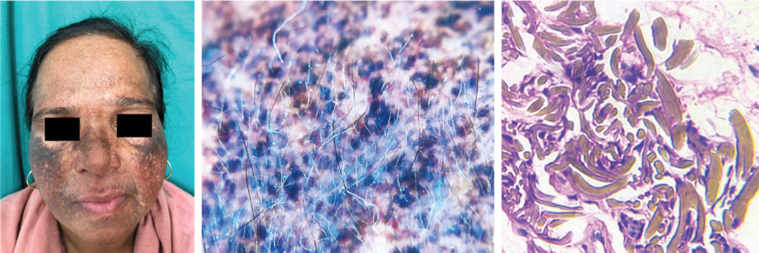 Image Challenge | The New England Journal of Medicine