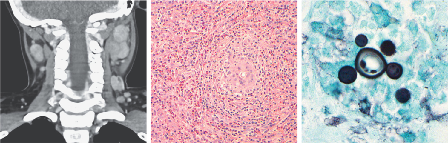 Image Challenge | The New England Journal of Medicine