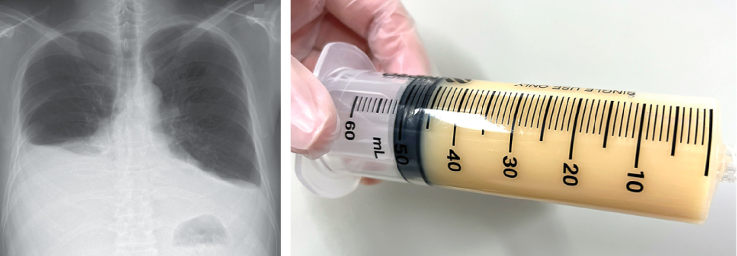 Image Challenge | The New England Journal of Medicine