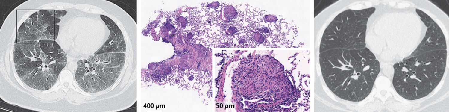 Image Challenge | The New England Journal of Medicine
