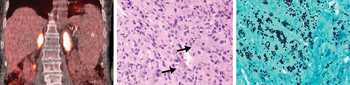 Image Challenge | The New England Journal of Medicine