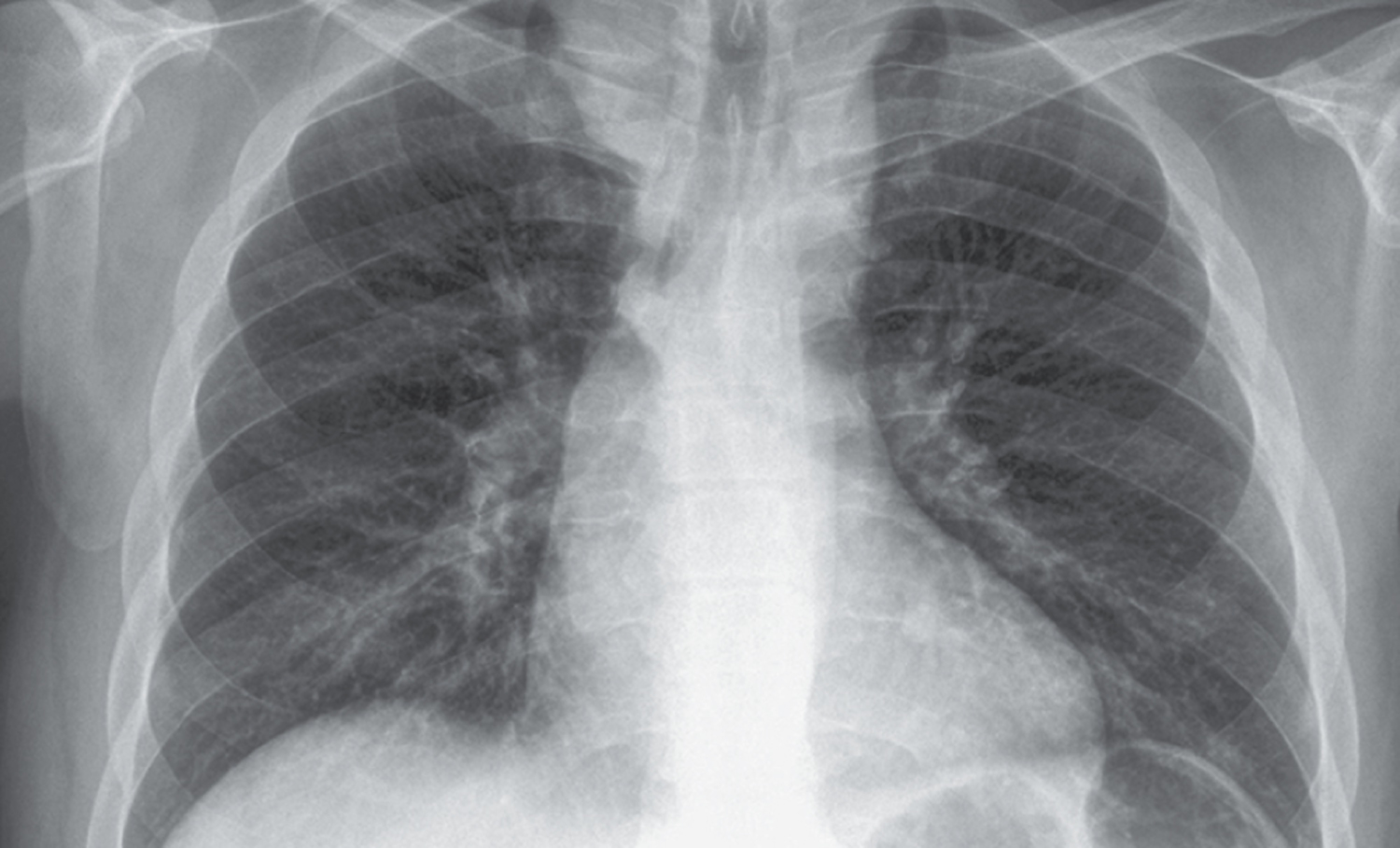 Image Challenge | The New England Journal of Medicine