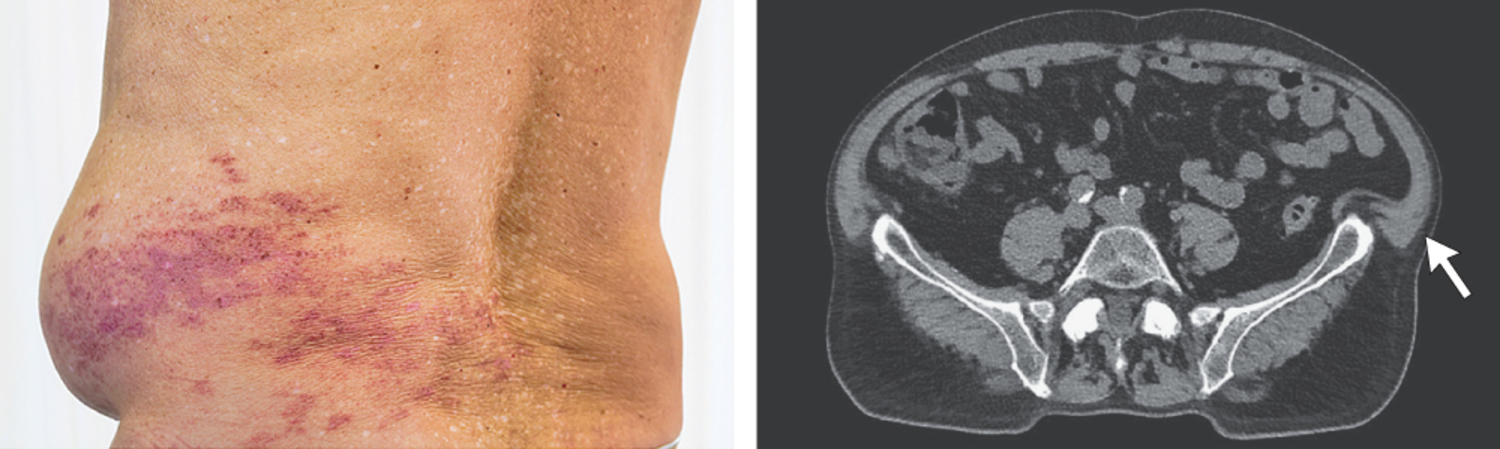 Image Challenge | The New England Journal of Medicine