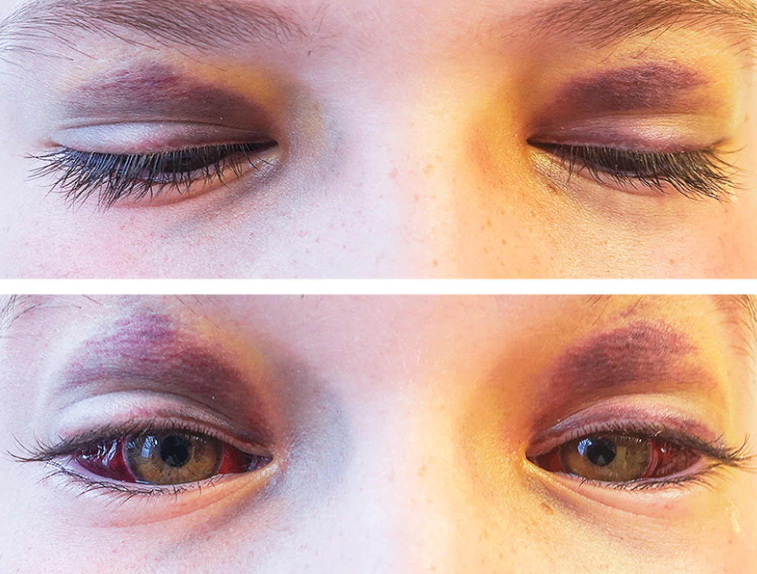 Image Challenge | The New England Journal of Medicine