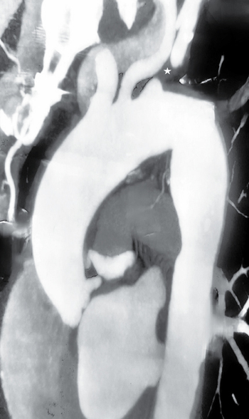 Image Challenge | The New England Journal of Medicine