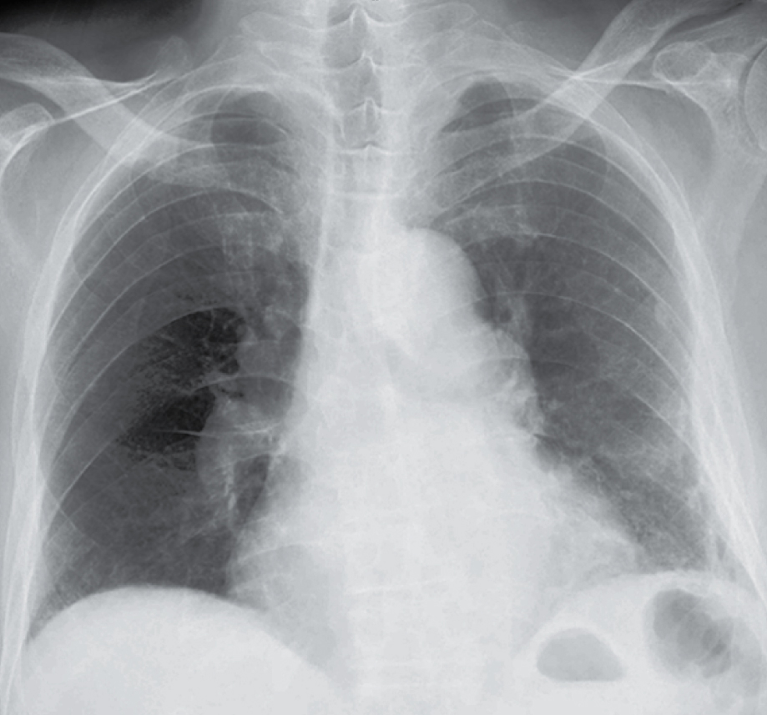 Image Challenge | The New England Journal of Medicine