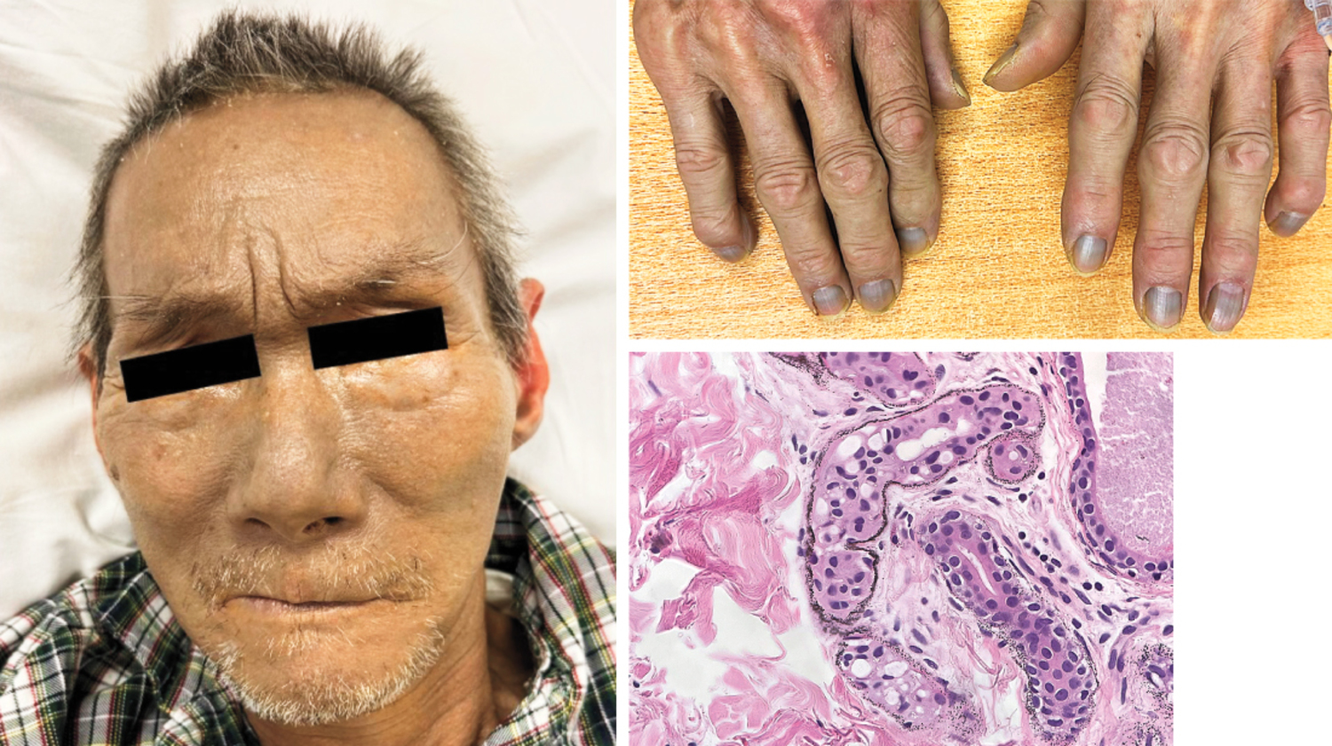 Image Challenge | The New England Journal of Medicine