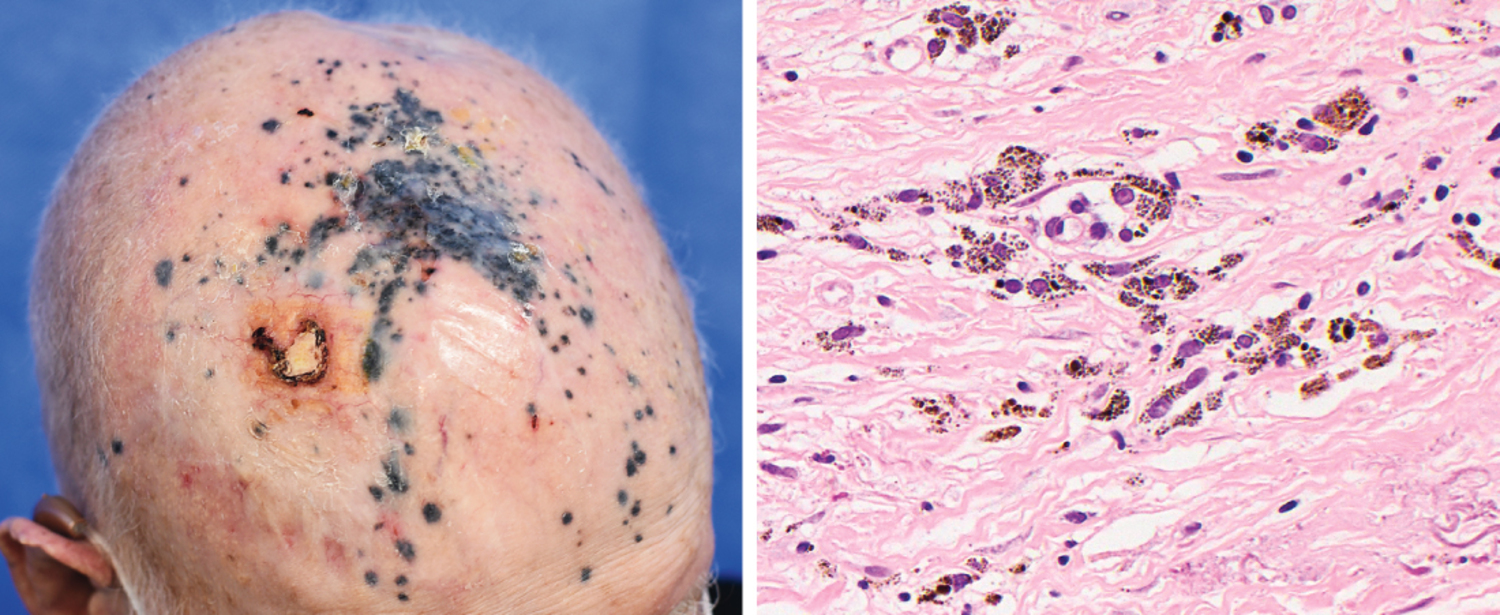 Image Challenge | The New England Journal of Medicine