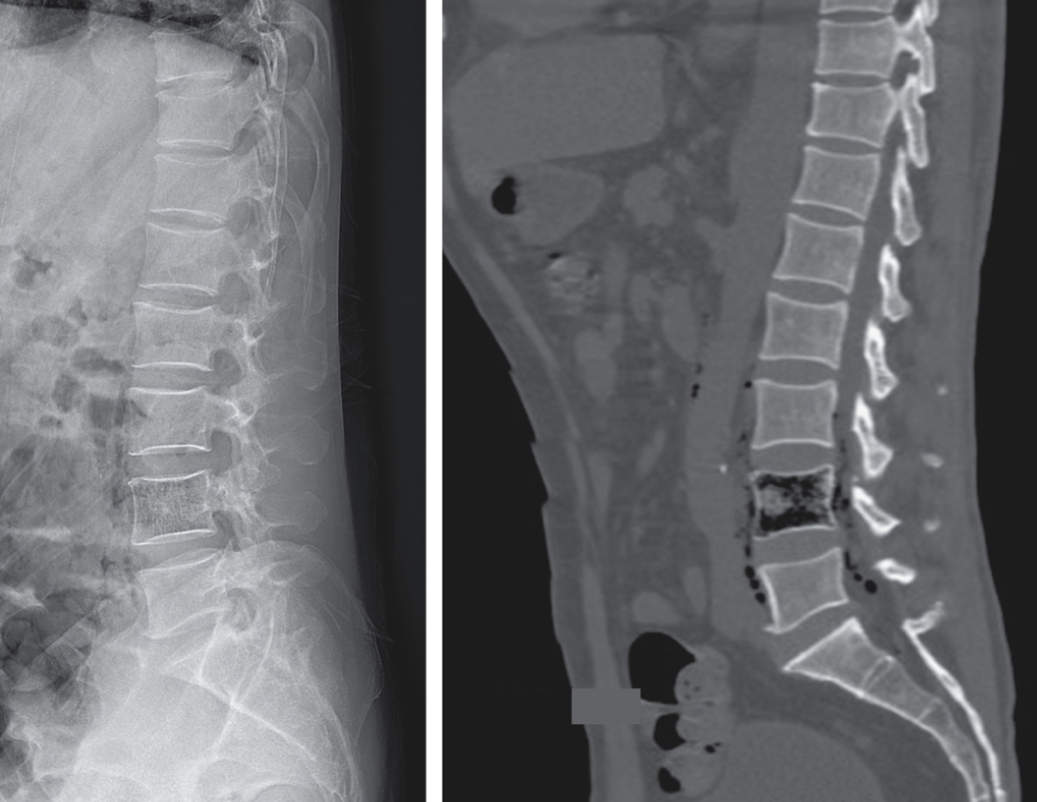 Image Challenge | The New England Journal of Medicine