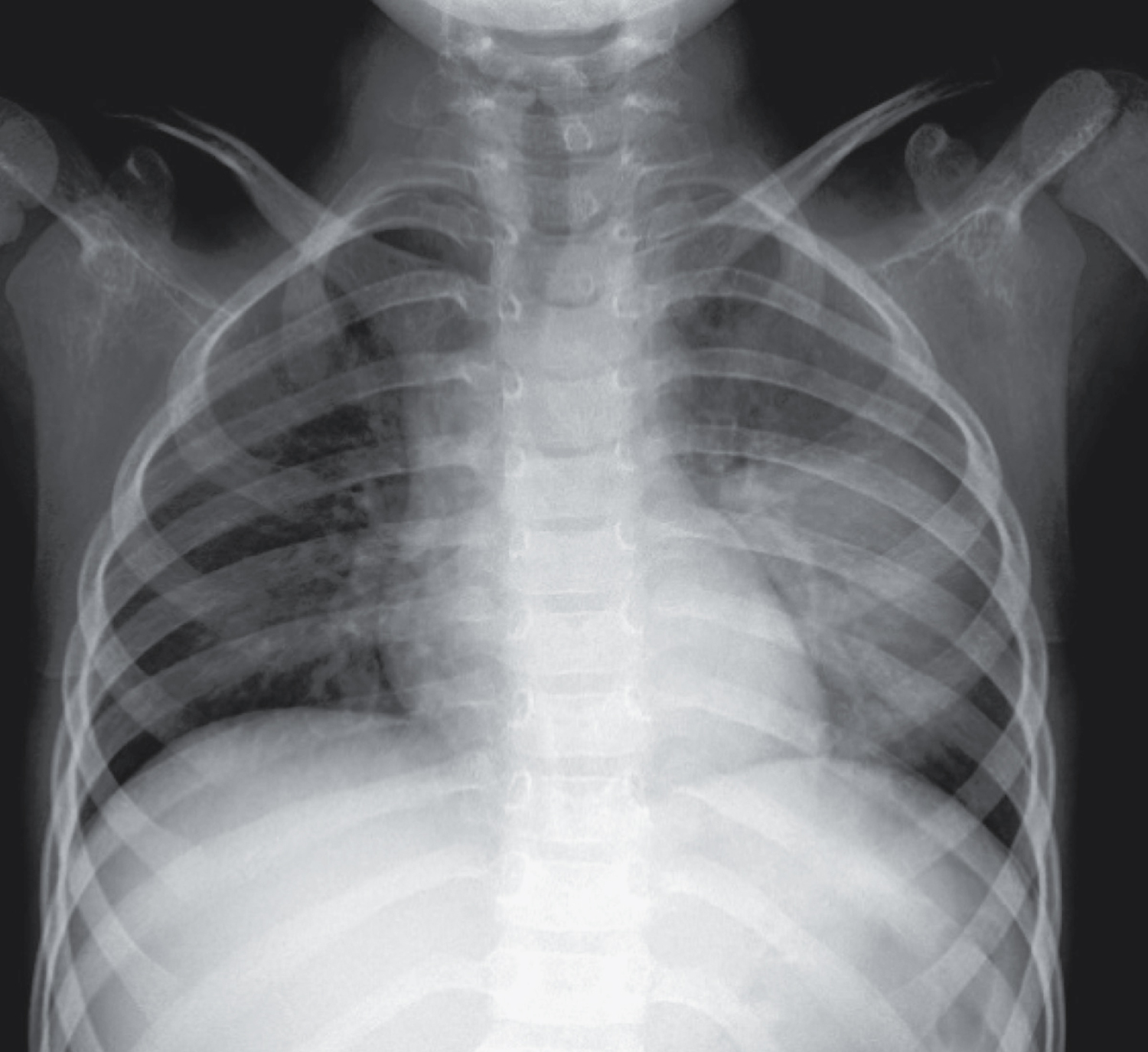 Image Challenge | The New England Journal of Medicine