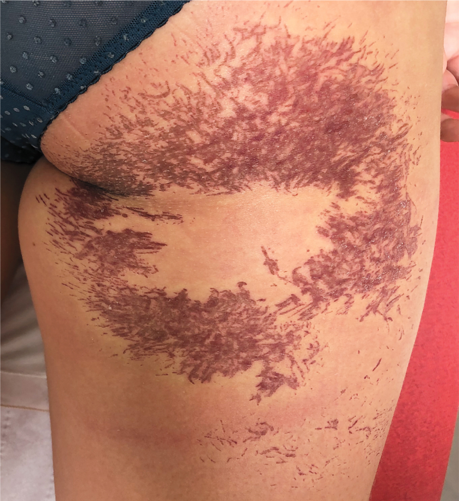 Image Challenge | The New England Journal of Medicine