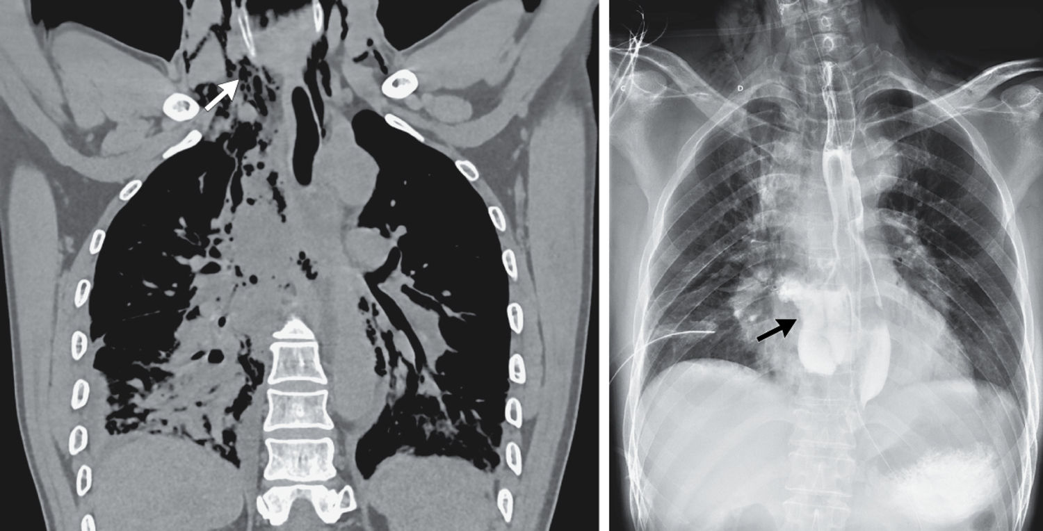 Image Challenge | The New England Journal of Medicine