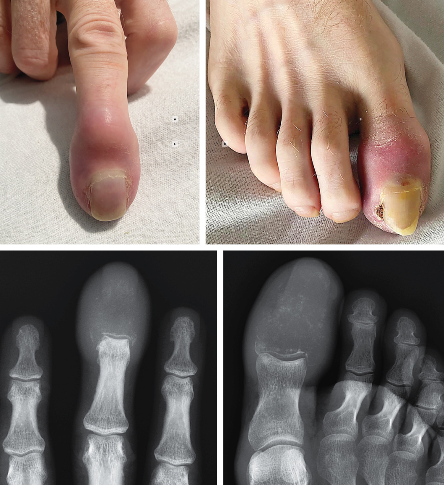 Image Challenge | The New England Journal of Medicine