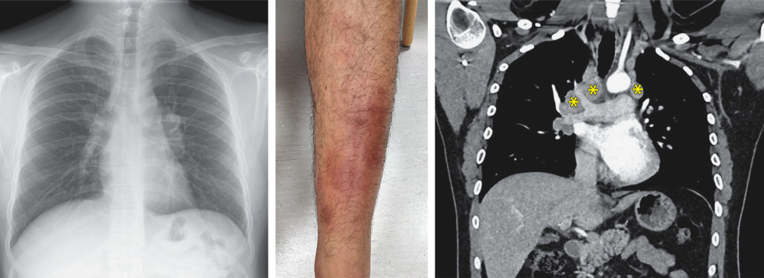 Image Challenge | The New England Journal of Medicine